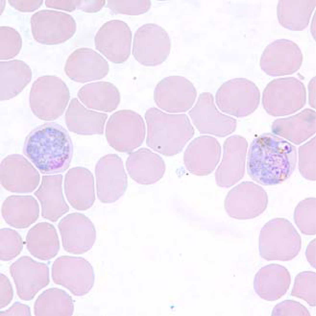 Gametocito De Plasmodium Ovale